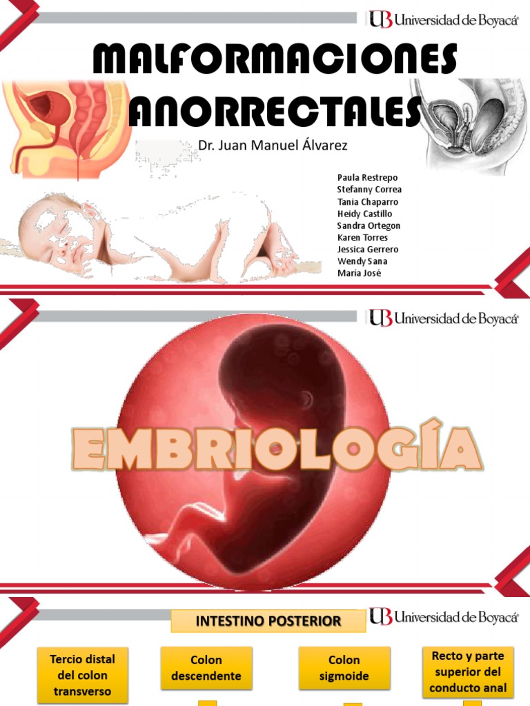 Malformaciones Anorrectales | PDF | Intestino grueso | Recto