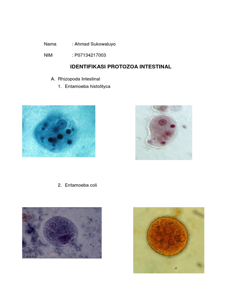 Identifikasi Protozoa Intestinal2 | PDF