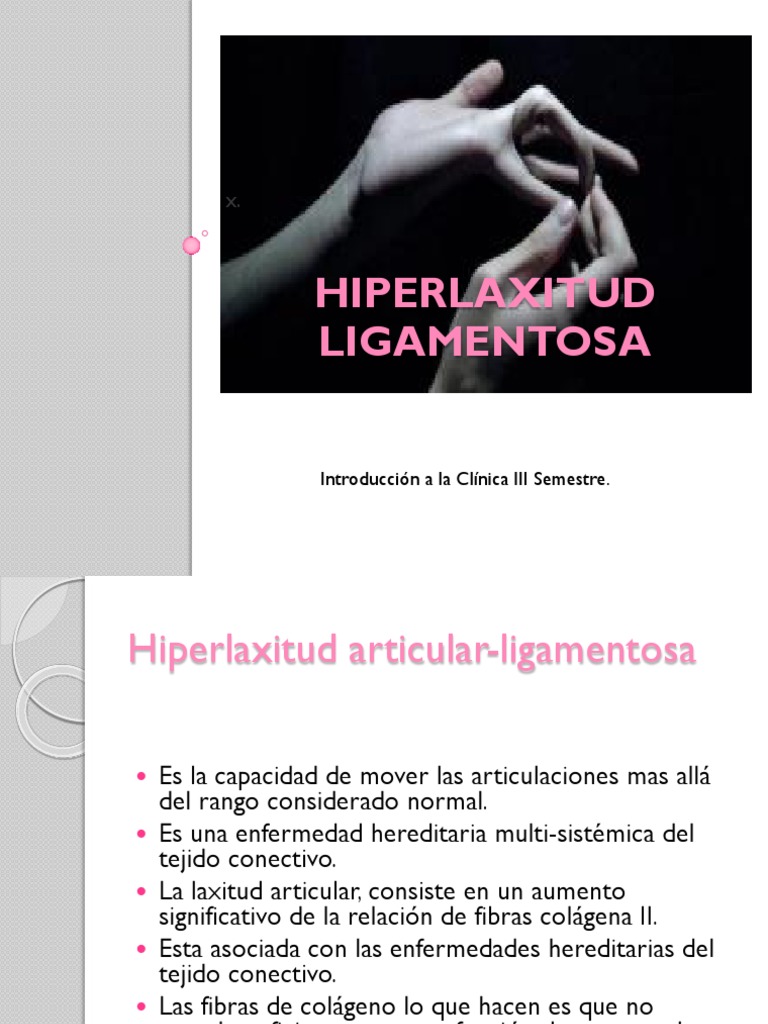 Hiperlaxitud Ligamentosa 2017 | PDF | Rodilla | Codo