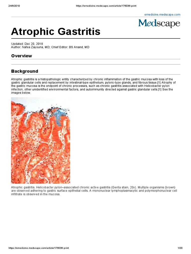 Atrophic Gastritis | PDF | Autoimmunity | T Helper Cell