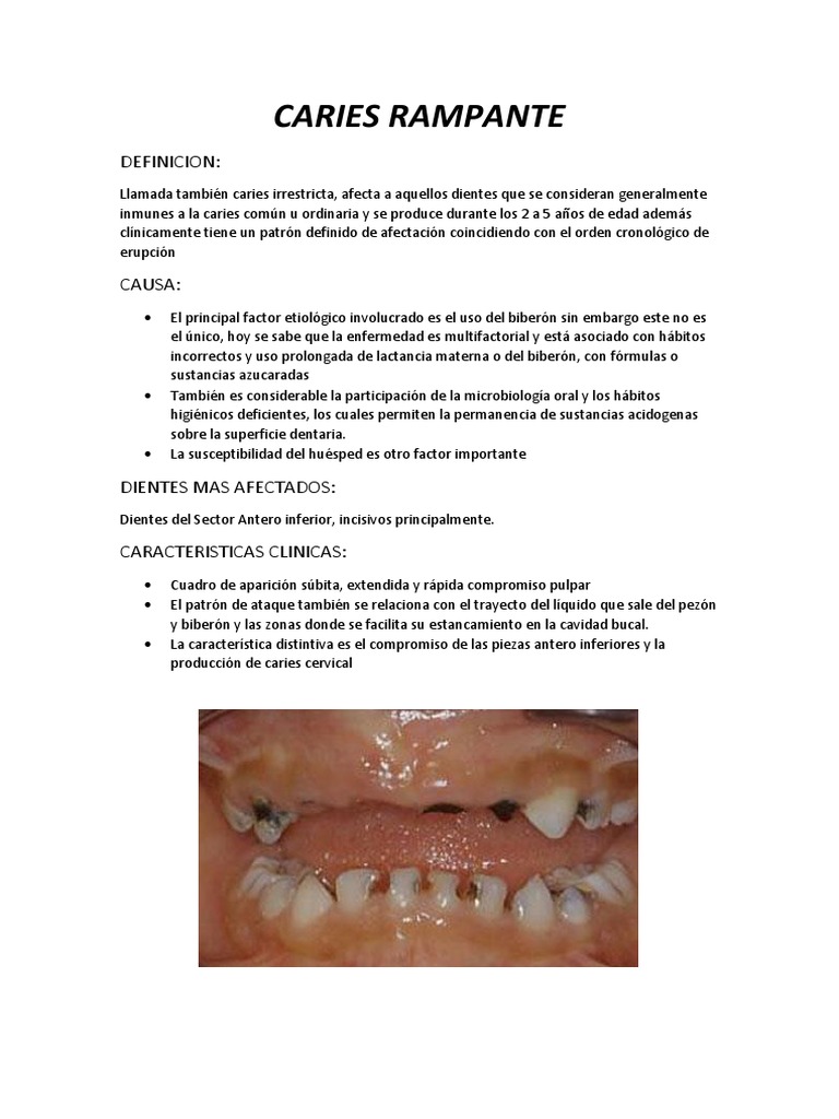 Caries Rampante | Epidemiología | Rtt