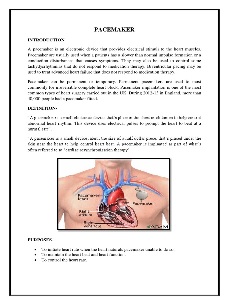 Pacemaker | PDF | Artificial Cardiac Pacemaker | Heart
