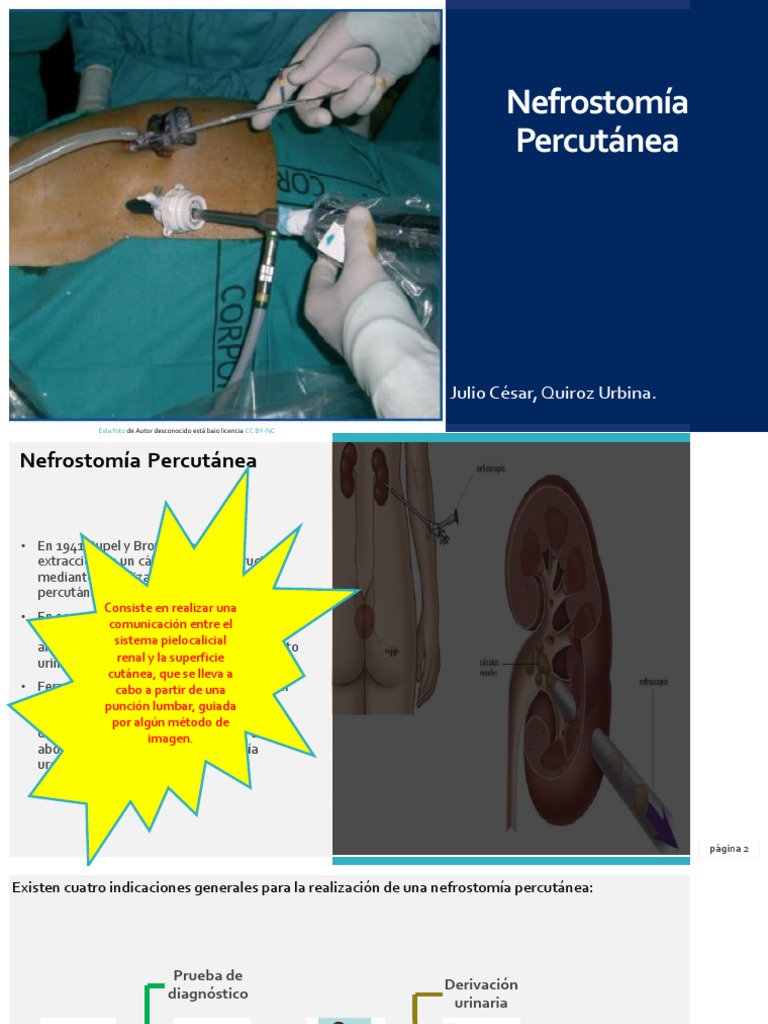 Nefrostomía Percutánea | PDF | Especialidades Medicas | Medicina CLINICA