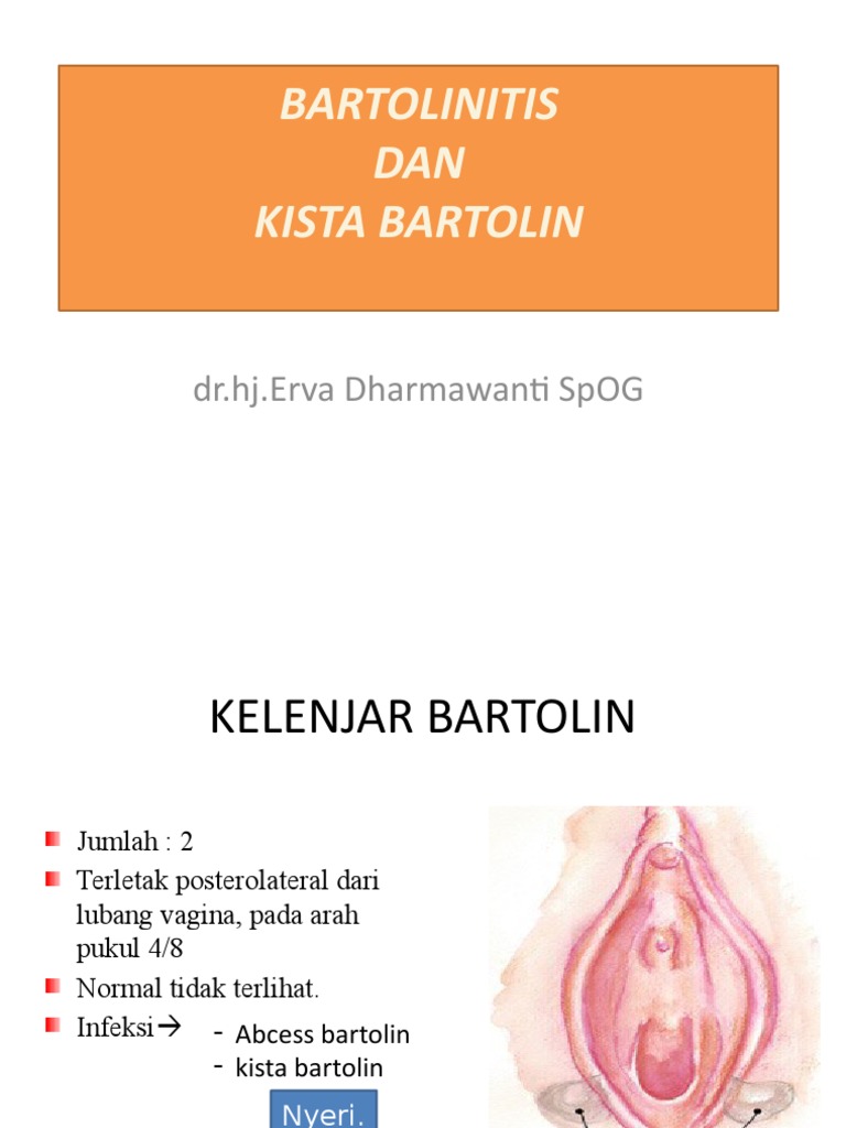 BARTOLINITIS | PDF