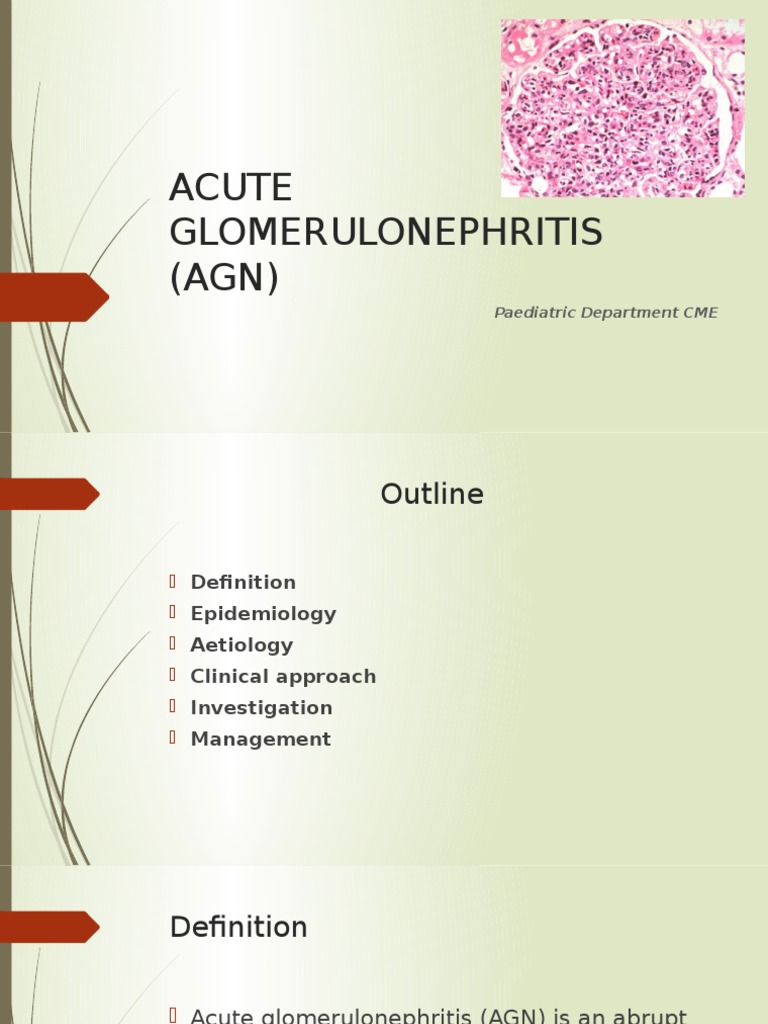 Acute Glomerulonephritis (AGN) : Paediatric Department CME | PDF ...