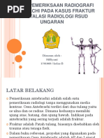 Thorax PA, AP Dan Lateral, RLD Dan LLD | PDF