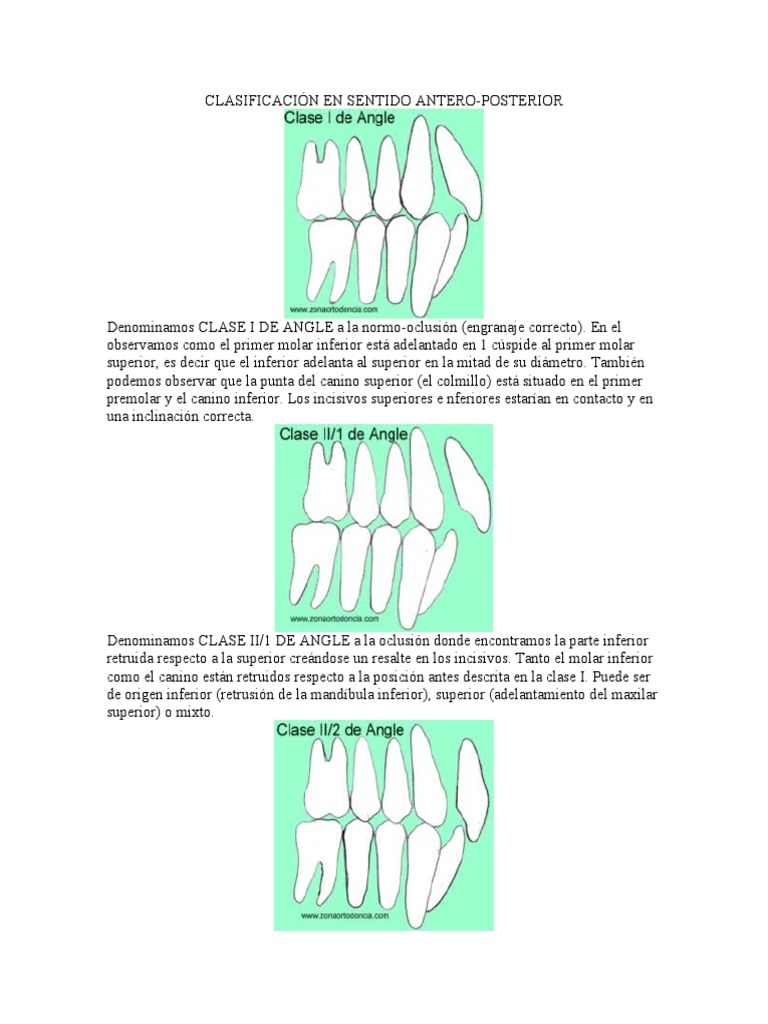 Clases de Angle | PDF