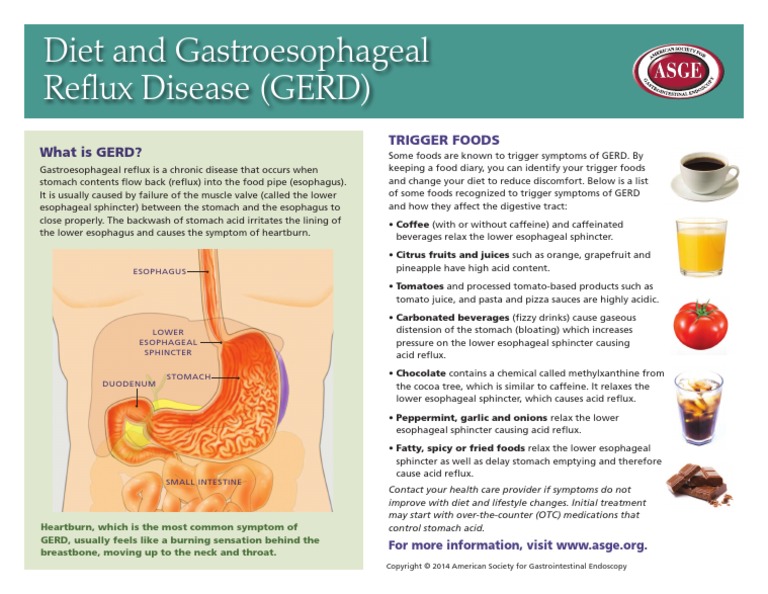 Doc-Gerd Infographic Final PDF | PDF | Gastroesophageal Reflux Disease ...