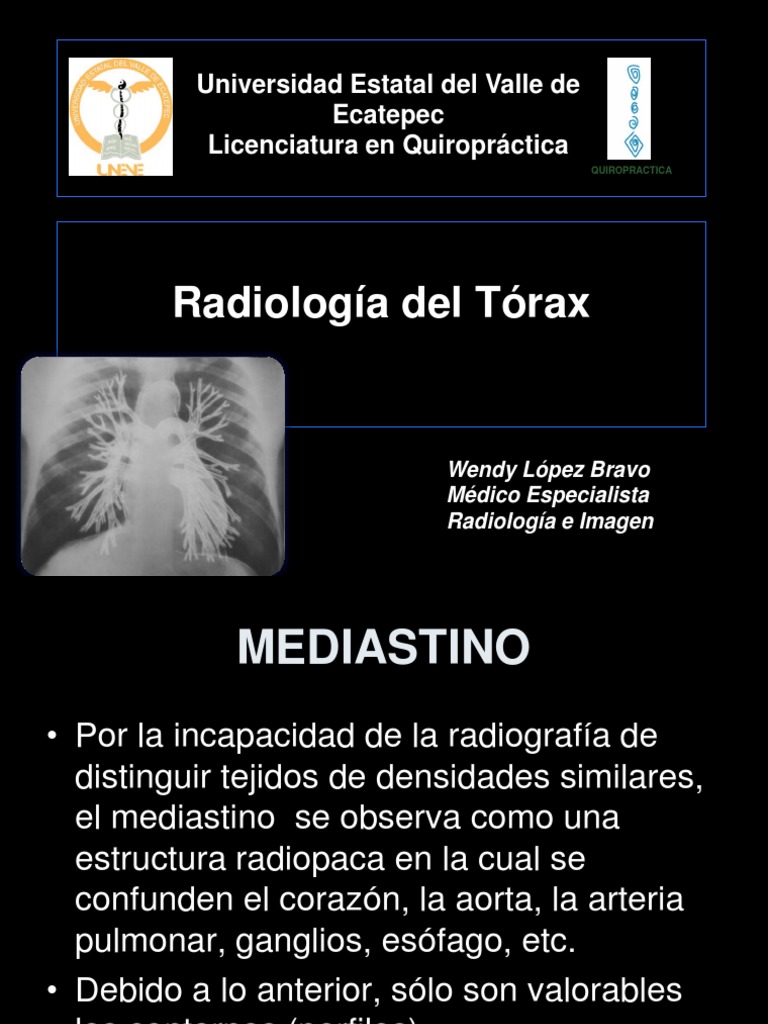 RX de Torax | PDF | Corazón | Aorta