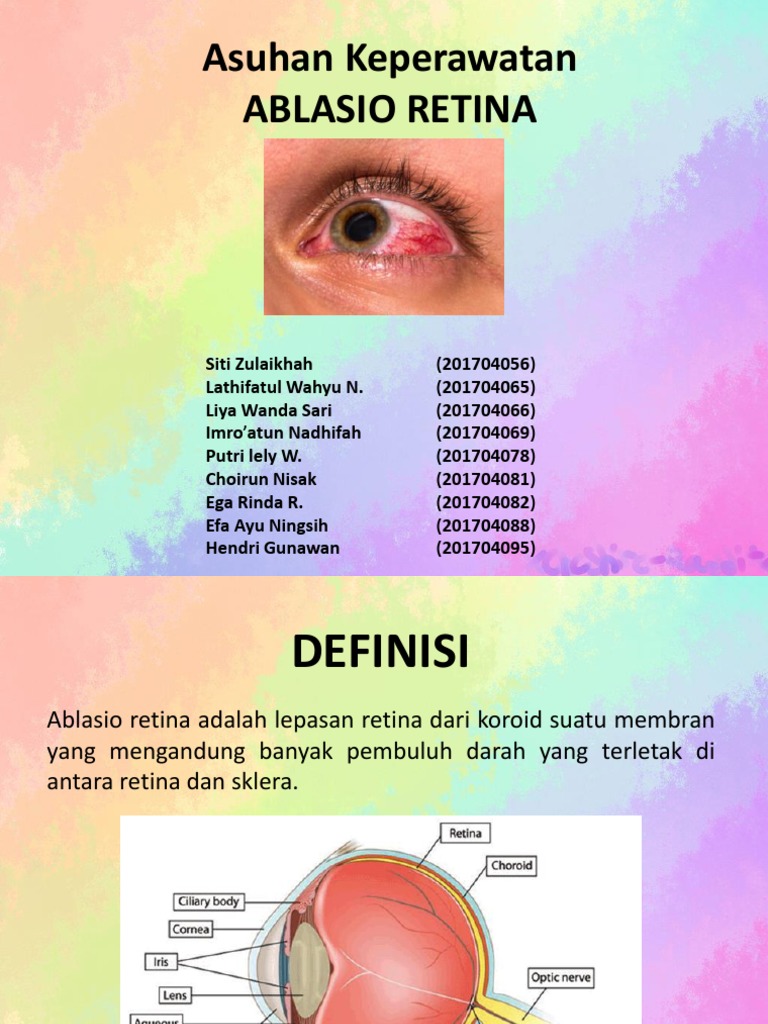 Ablasio Retina | PDF