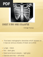 Chest X-Ray Template | PDF | Lung | Thorax