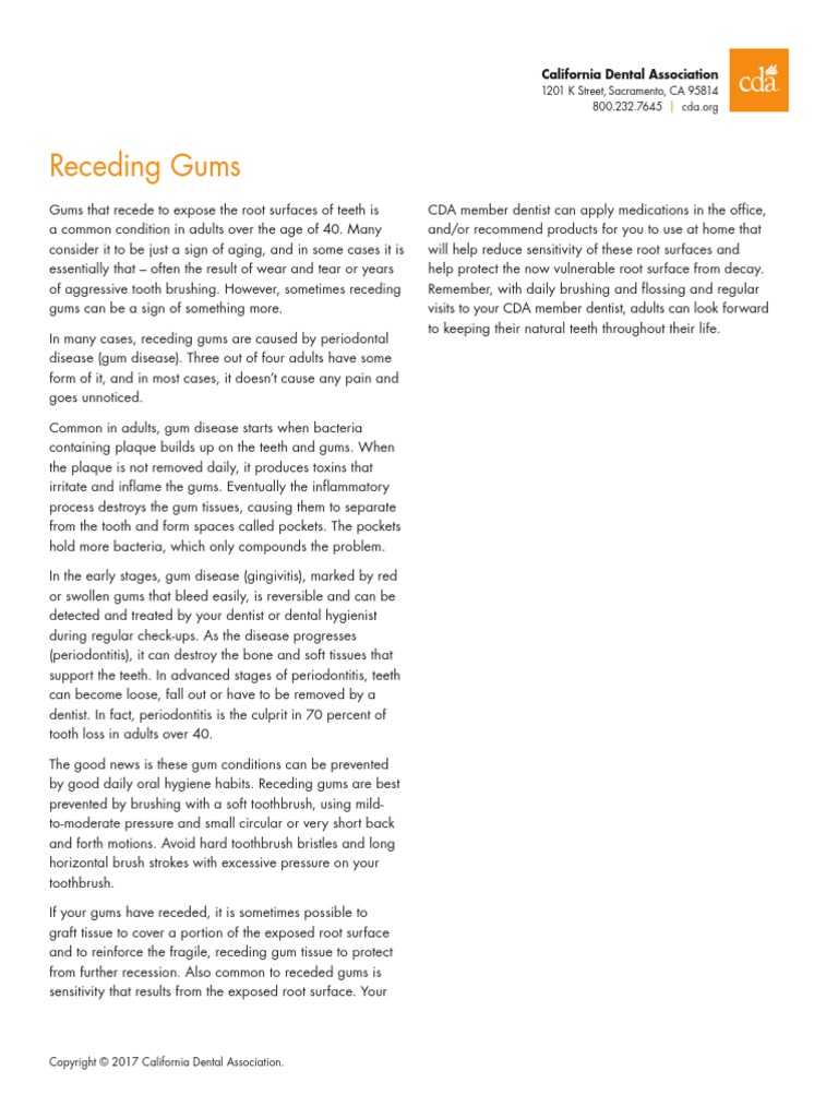 Receding Gums: 1201 K Street, Sacramento, CA 95814 800.232.7645 | PDF ...