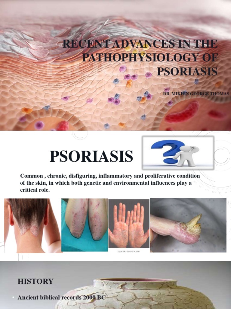 Pathophysiologyofpsoriasis 140227055421 Phpapp02 | PDF | Psoriasis ...