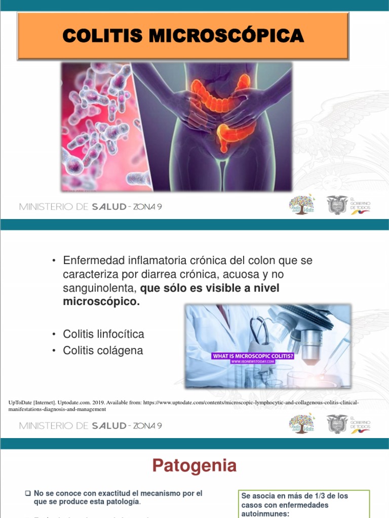 Colitis Microscopica | PDF | Cáncer colonrectal | Diarrea