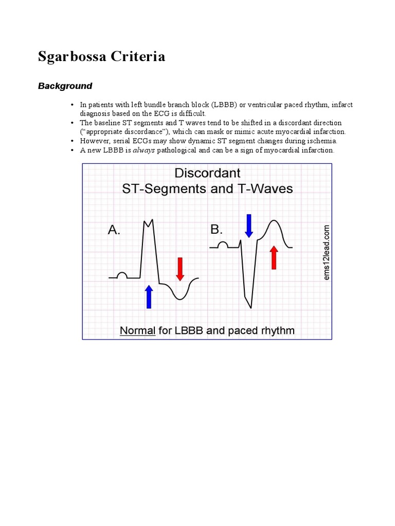 Sgarbossa Crtiteria | PDF | Electrocardiography | Myocardial Infarction