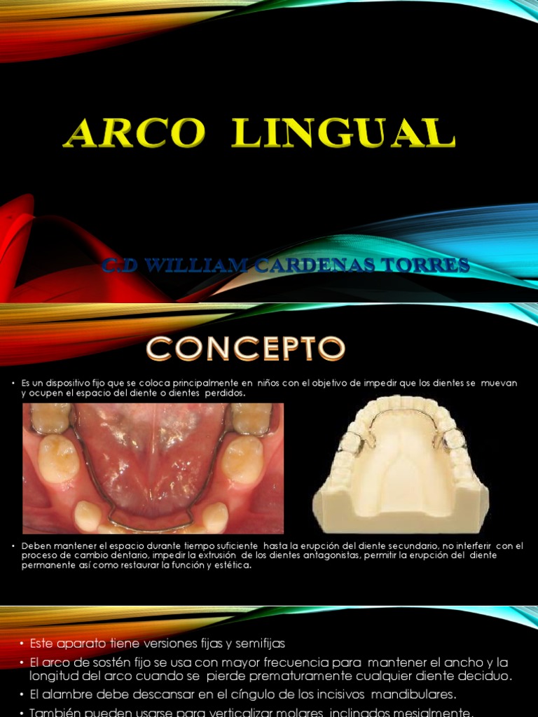 El arco lingual: Características, indicaciones y procedimiento de ...