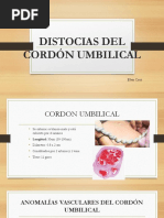 Distocia Funicular: Definición y Evaluación | PDF | Parto | Feto