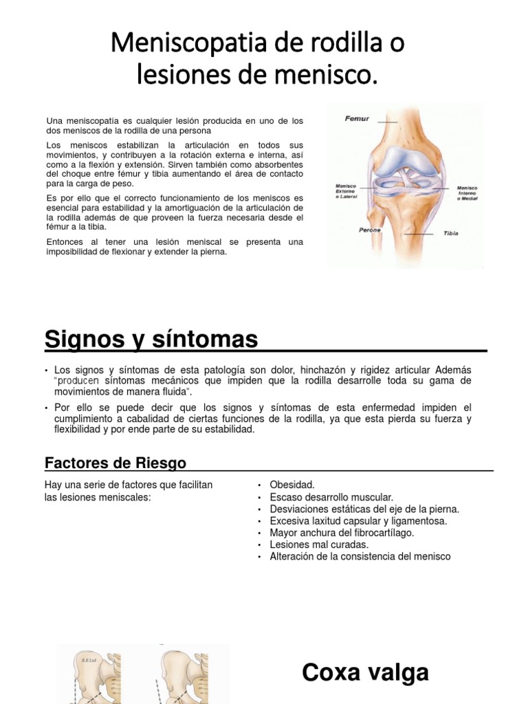Meniscopatia de Rodilla o Lesiones de Menisco | PDF