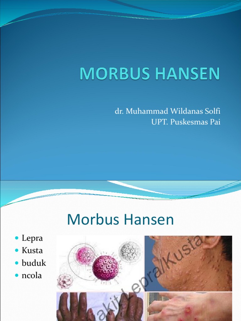 Morbus Hansen Cba | PDF