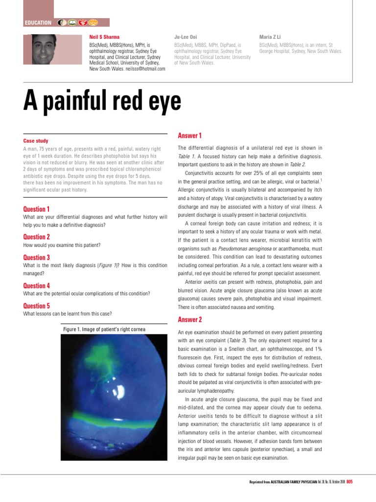 Red Eye Check | PDF | Glaucoma | Contact Lens