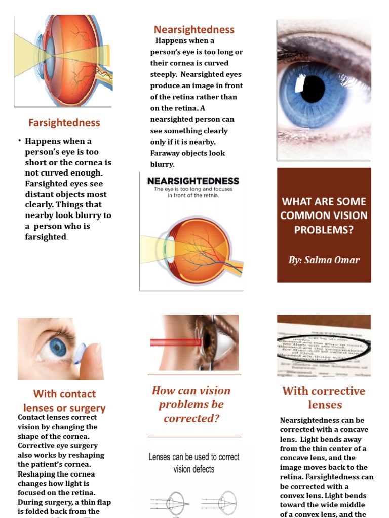 Nearsightedness: What Are Some Common Vision Problems? | PDF