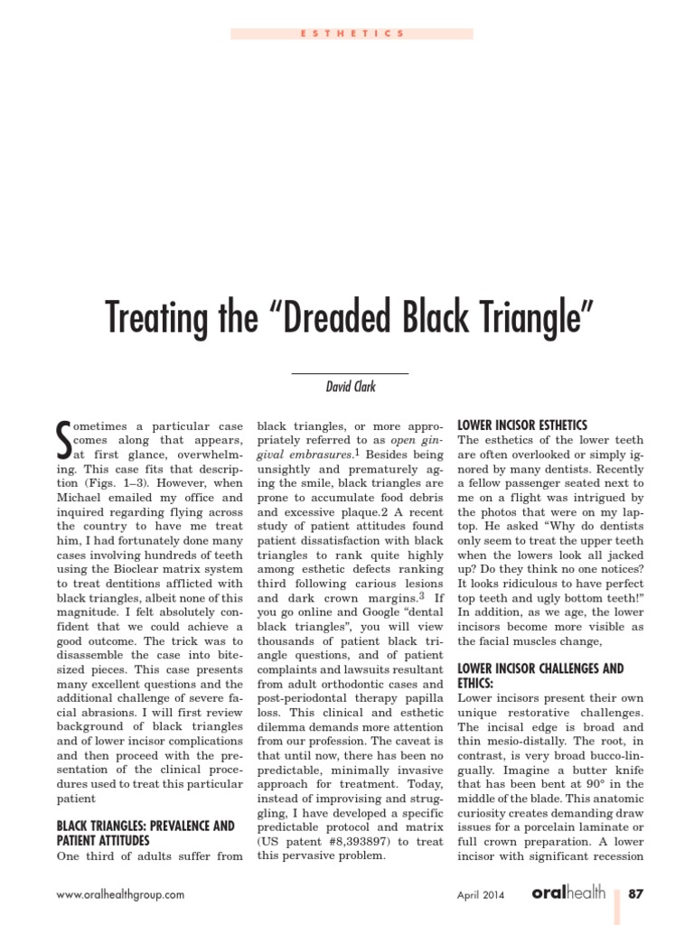 Treating The Dreaded Black Triangle | PDF | Tooth | Tooth Enamel