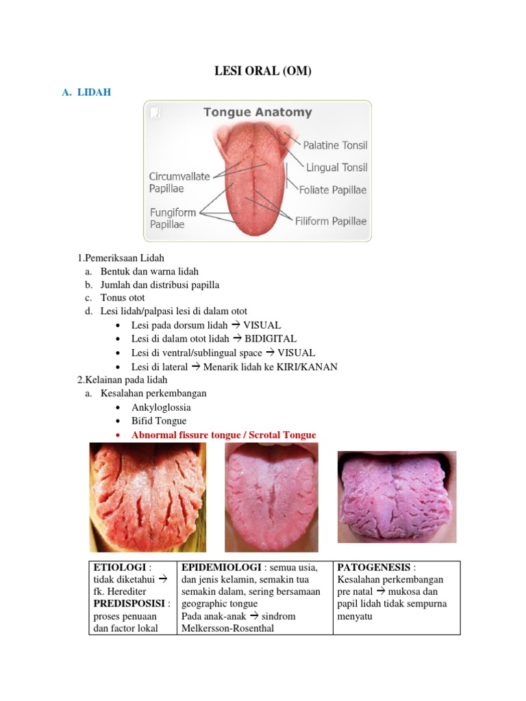 Lesi dan Pigmentasi pada Lidah | PDF