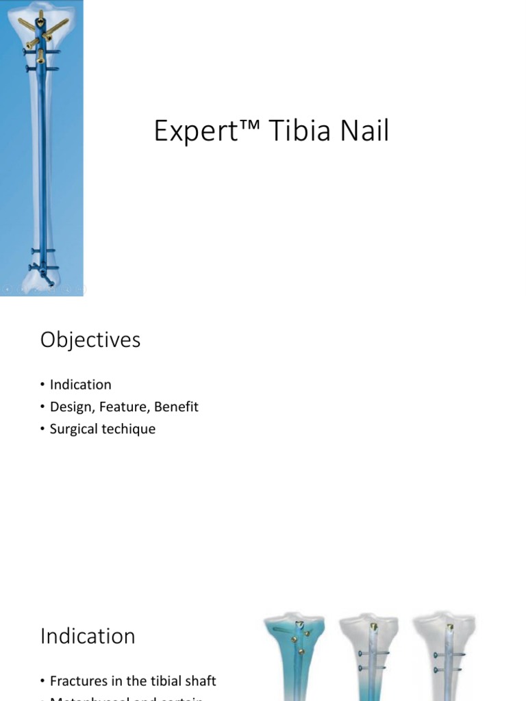 Expert Tibia Nail | PDF | Knee | Anatomical Terms Of Location