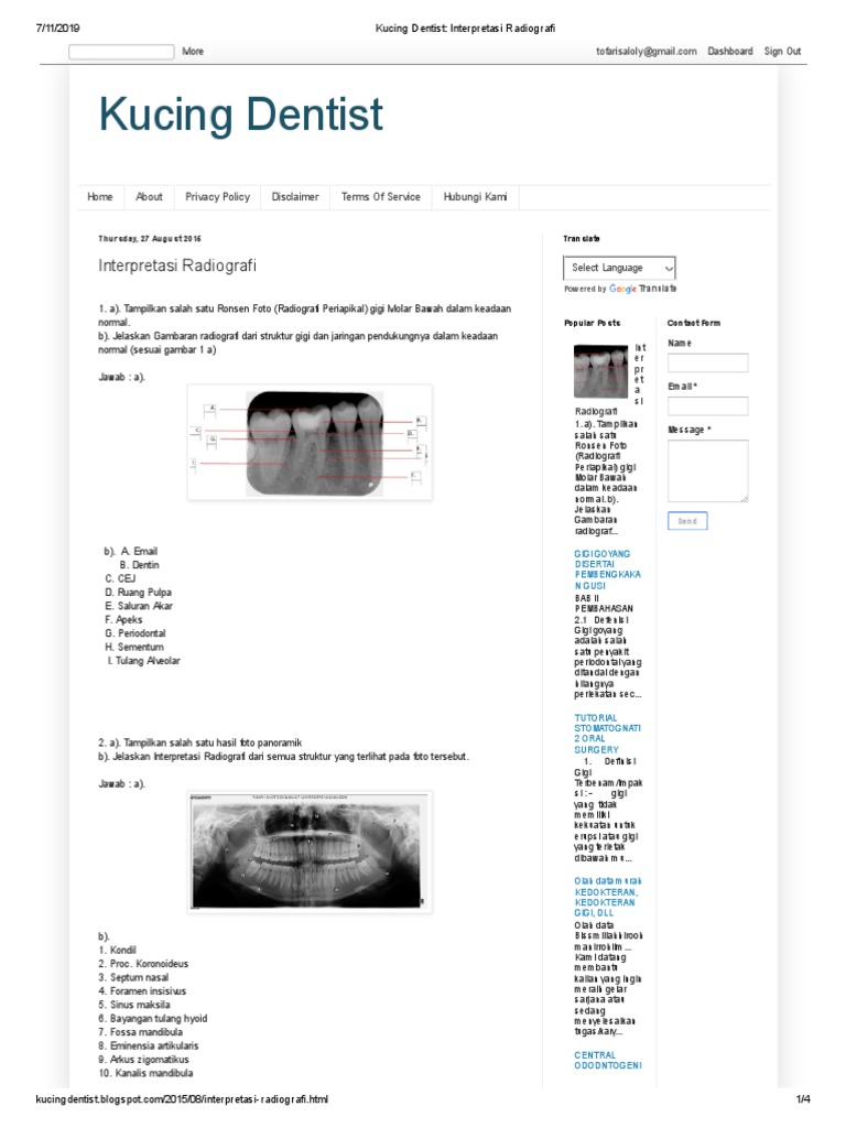 Interpretasi Radiografi | PDF