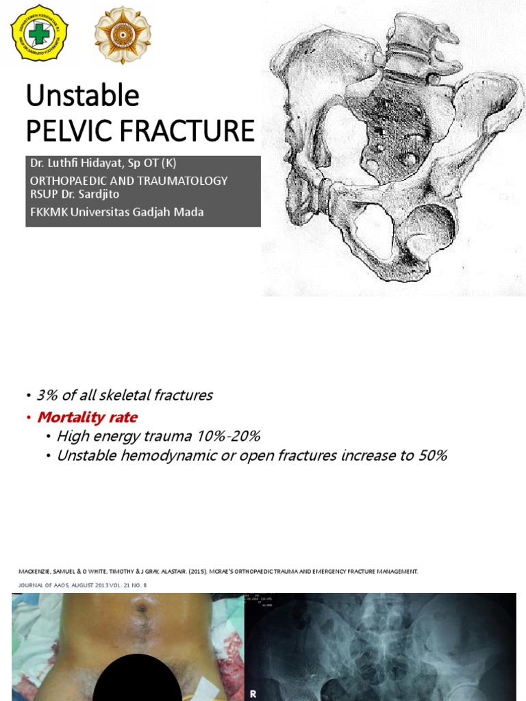 Stable Pelvic Fracture Protocol – VLLJO