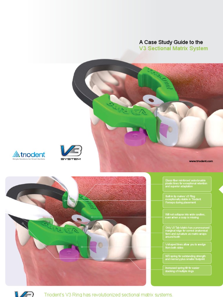 A Case Study Guide To The V3 Sectional Matrix System | PDF | Dentistry ...