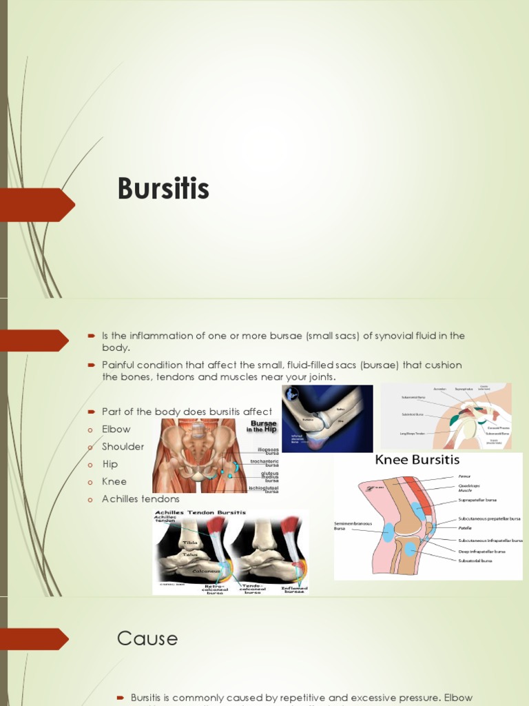 Bursitis | PDF | Dance Science | Musculoskeletal Disorders