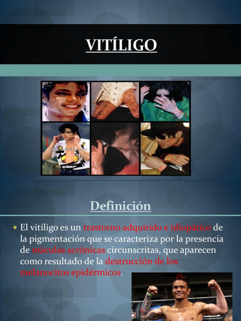 Vitíligo, Melasma y Fitofotodermatosis | PDF | Dermatología ...