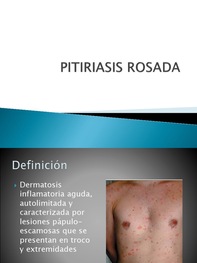 Pitiriasis Rosada | PDF