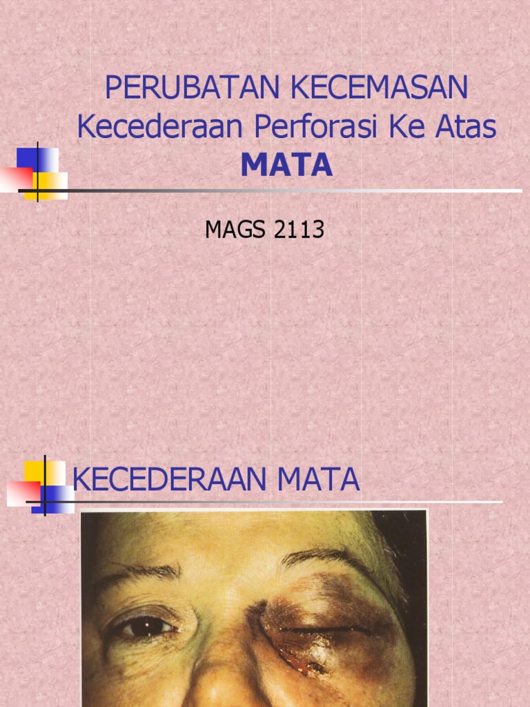 Perforasi Mata | PDF | Sains & Matematika