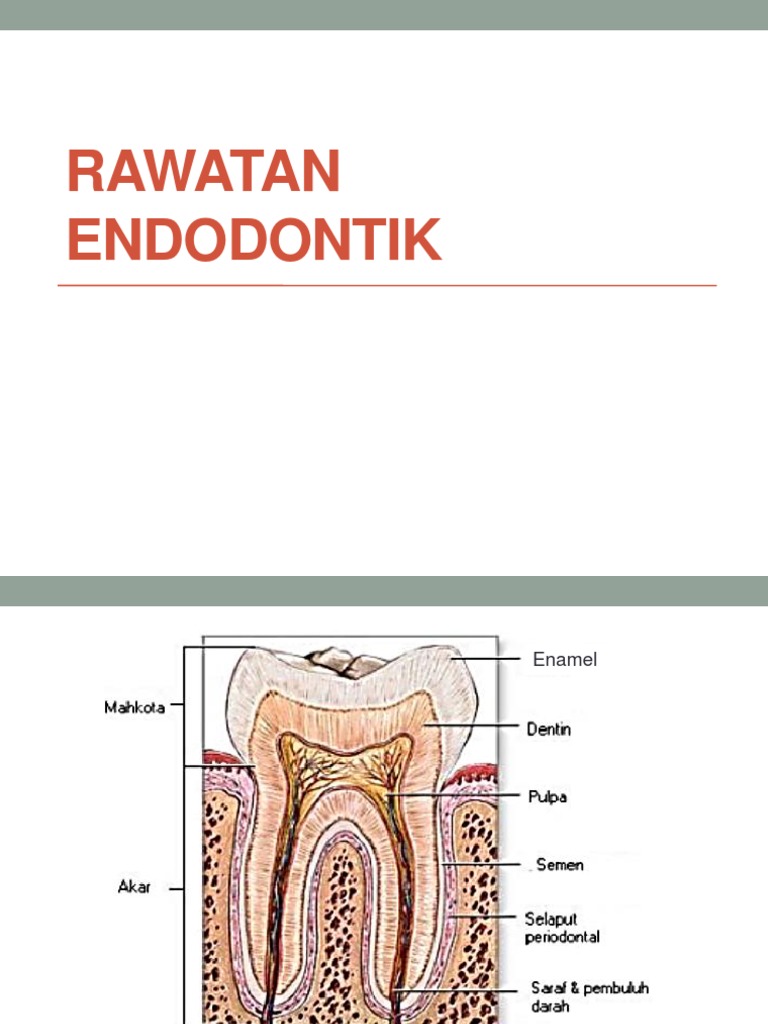 Rawatan Endodontik | PDF