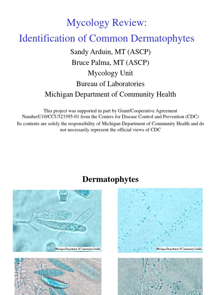Mycology Review: Identification of Common Dermatophytes | PDF | Fungus ...