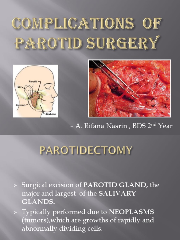 Complications of Parotid Surgery | PDF | Medical Specialties | Human ...