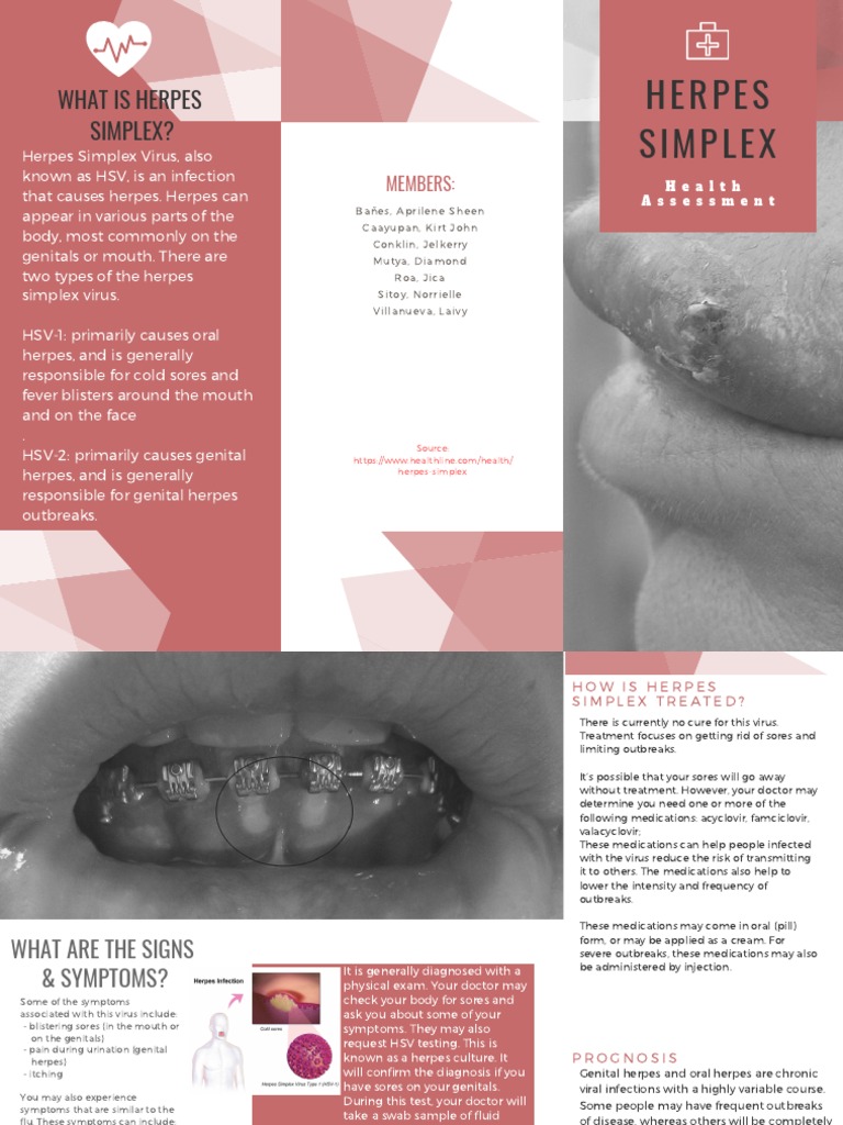 Herpes Simplex | PDF | Herpes Simplex | Virology