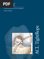 AC Joint Repair Arthrex | PDF | Surgical Suture | Joints