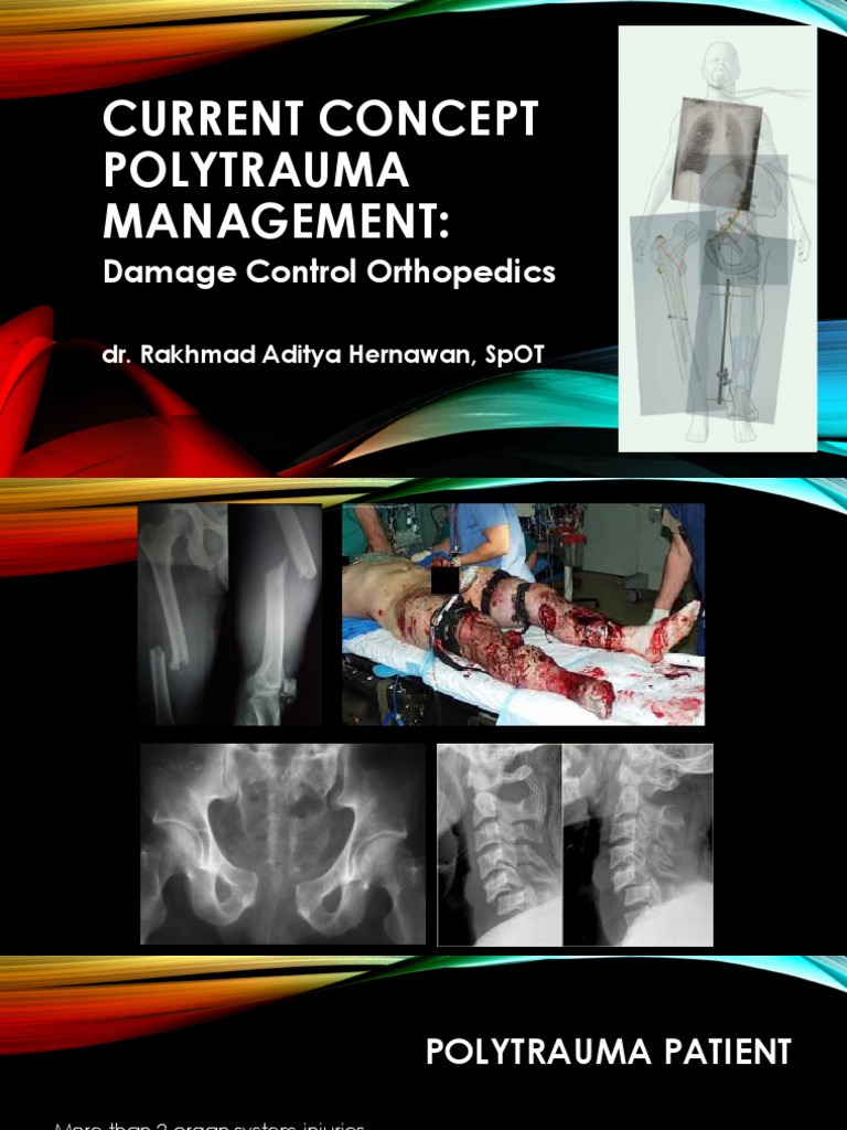Damage Control in Polytrauma Management | PDF | Orthopedic Surgery ...
