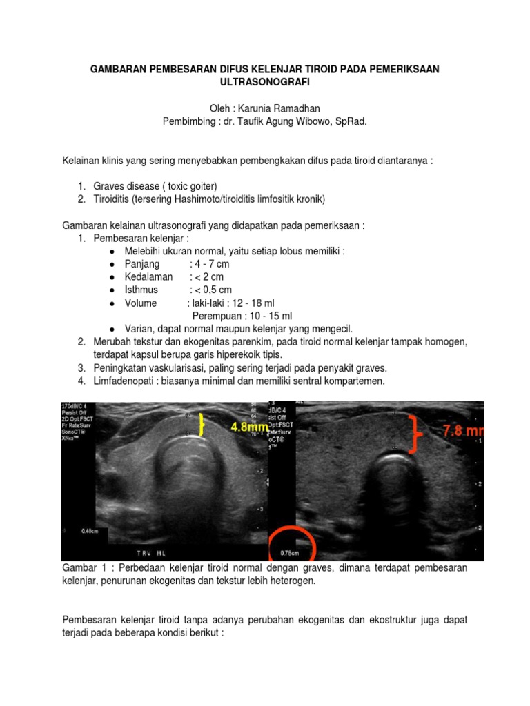 Gambaran Pembesaran Difus Kelenjar Tiroid Pada Pemeriksaan ...
