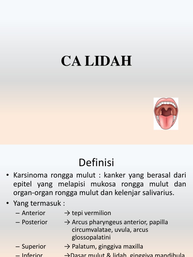 CA Lidah Fix | PDF | Cancer | Human Anatomy