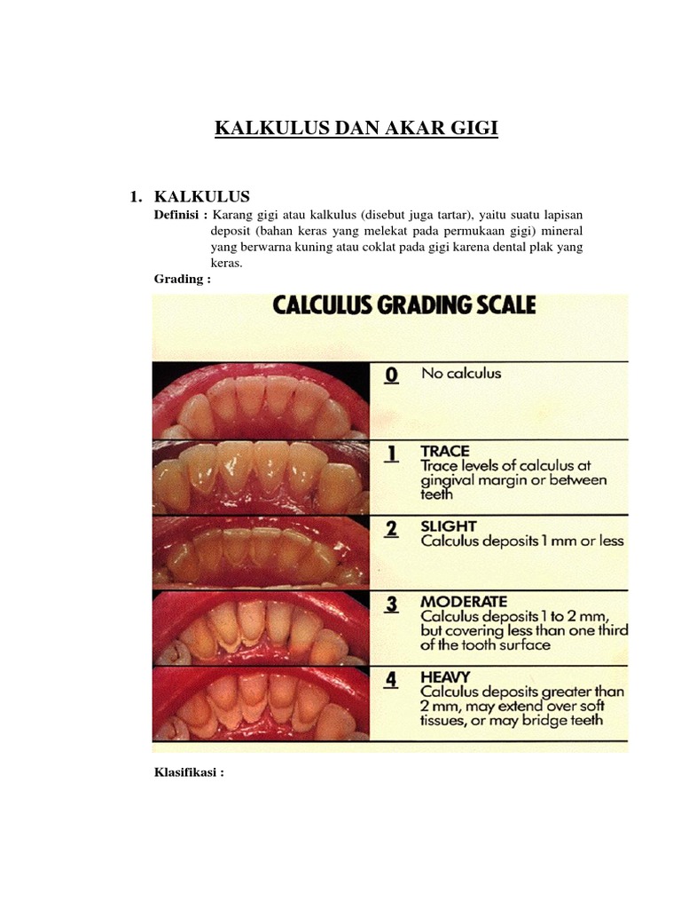 Kalkulus Dan Akar Gigi | PDF