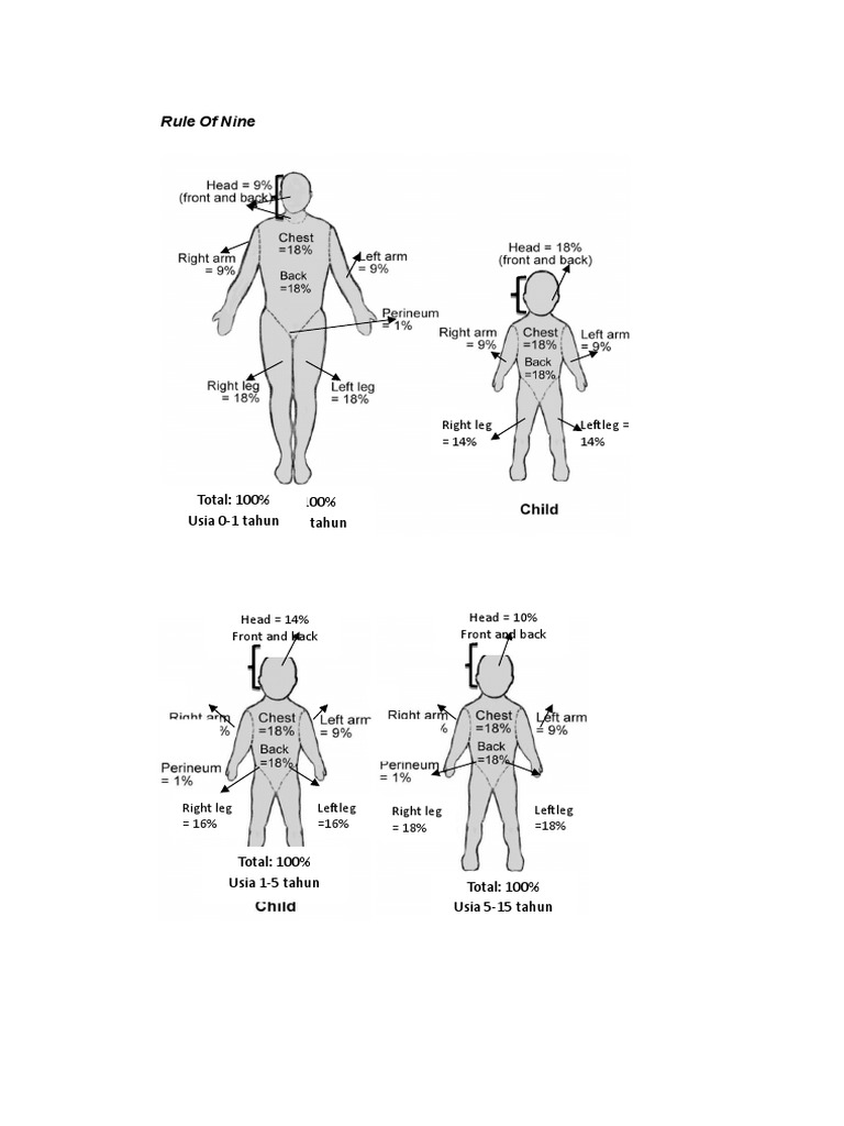 Understanding the Rule of Nines | PDF