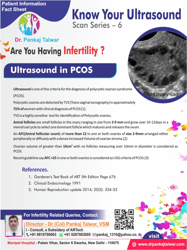 Ultrasound in PCOS | PDF