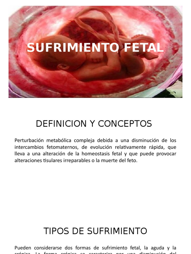 Distocia Fetal | PDF | Pelvis | Parto