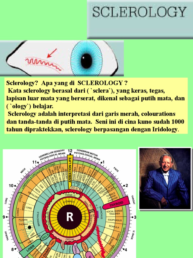 SCLEROLOGY MILLER.10!6!2012 | Sensory Organs | Ophthalmology