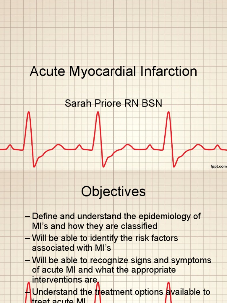 Understanding Acute Myocardial Infarction: Risk Factors, Signs ...