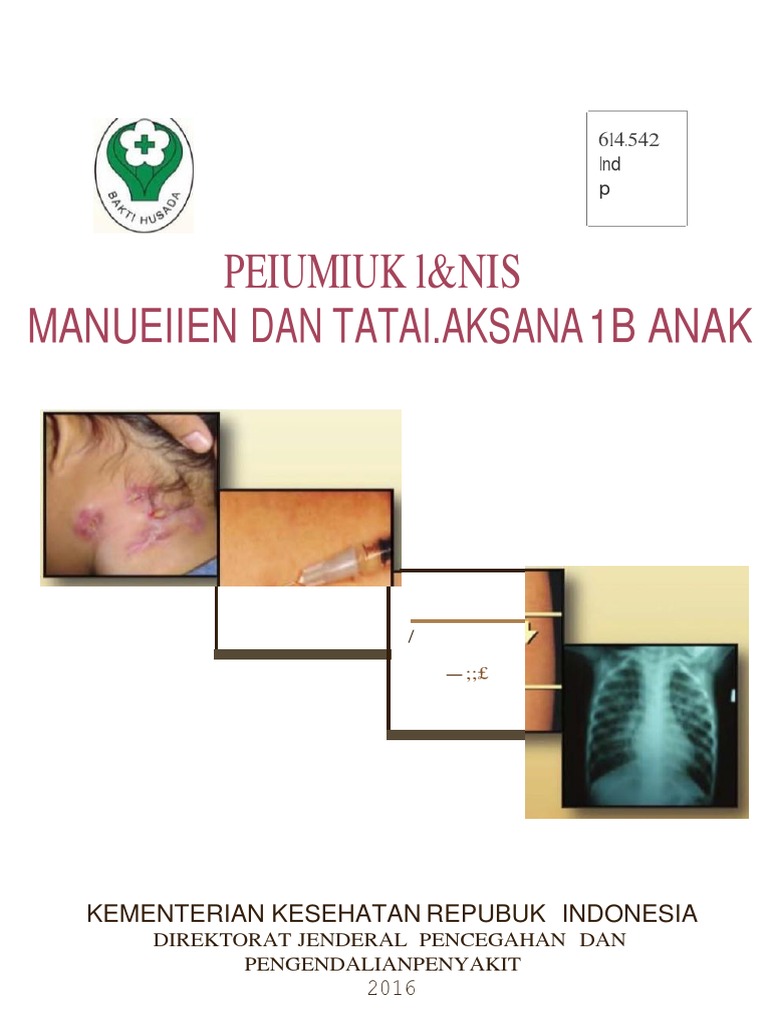 Buku Petunjuk Teknis Manajemen Dan Tatalaksana TB Anak | PDF